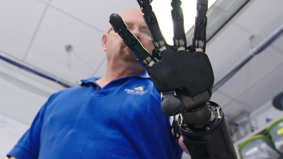 The Most Advanced Prosthetic Arm in the World