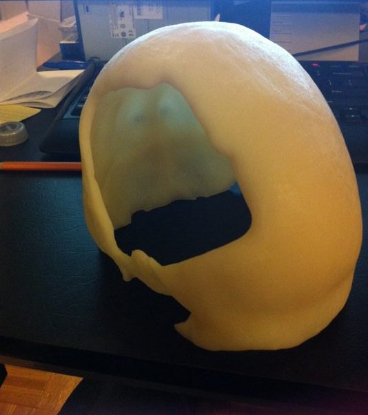 How to rebuild a broken brain