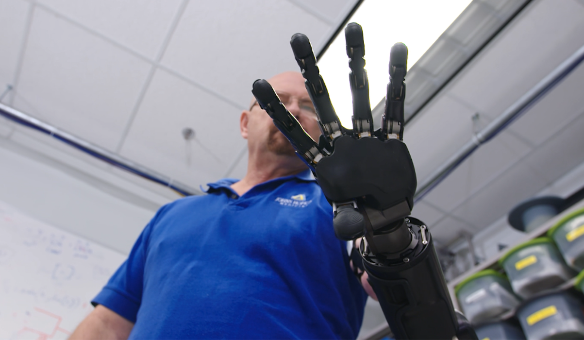 Here's the World's Most Advanced Bionic Arm