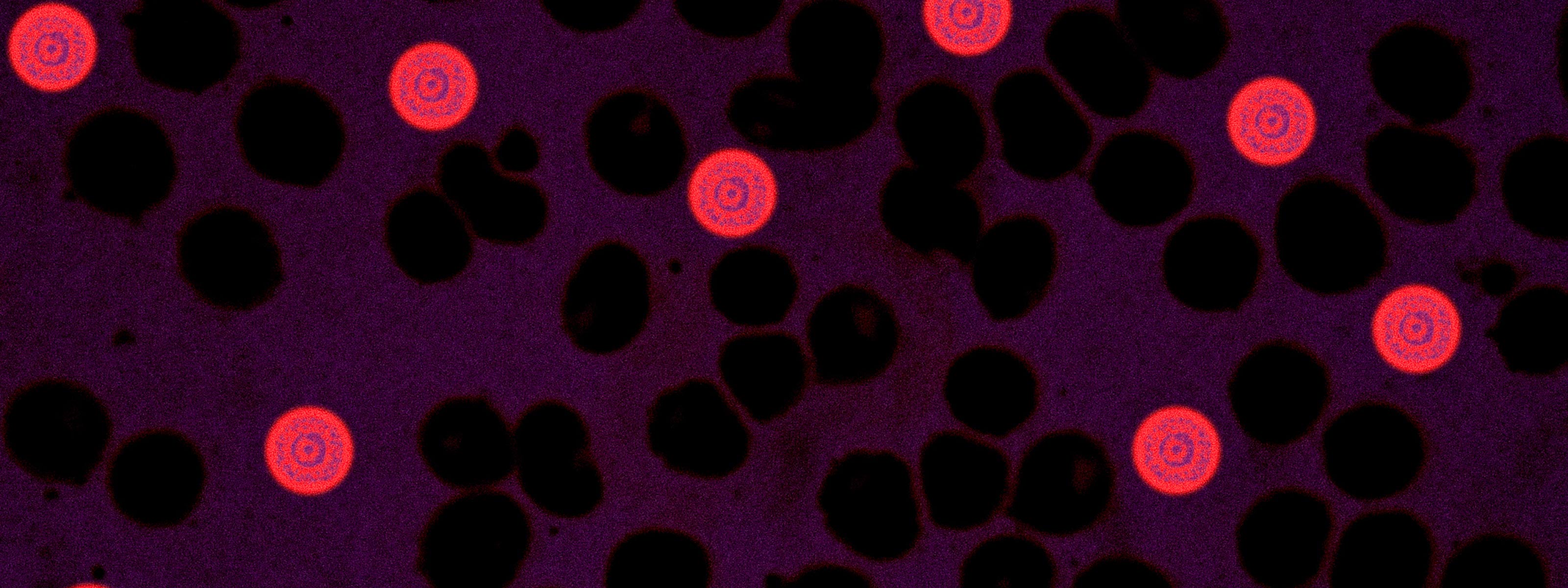 Nanoparticles Disguised as Red Blood Cells Sponge up Toxins