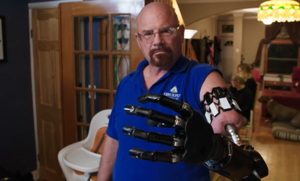 Here's the World's Most Advanced Bionic Arm