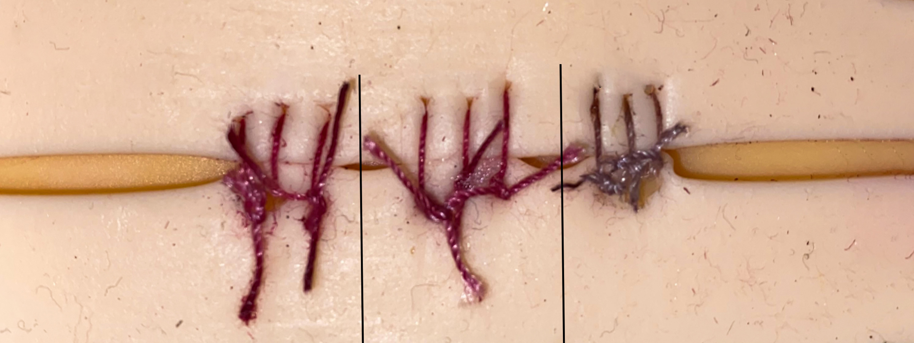 These color-changing sutures can catch infections