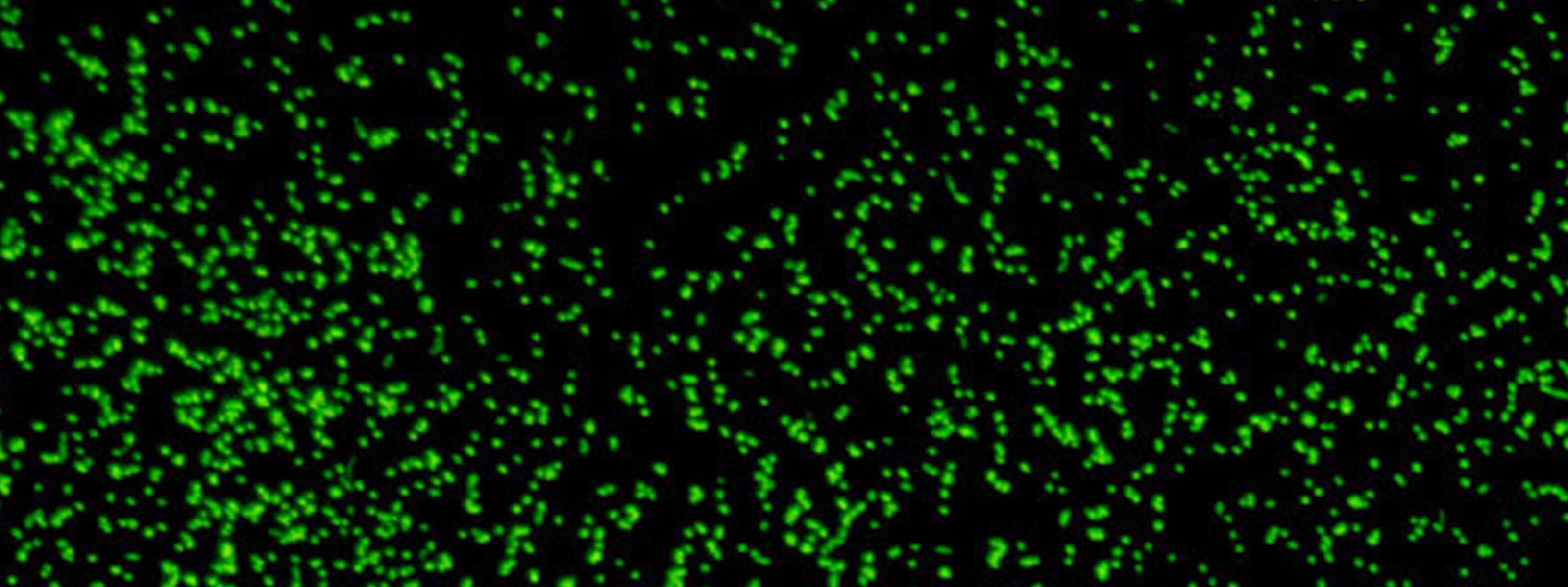 Researchers discover living 100-million-year-old microbes