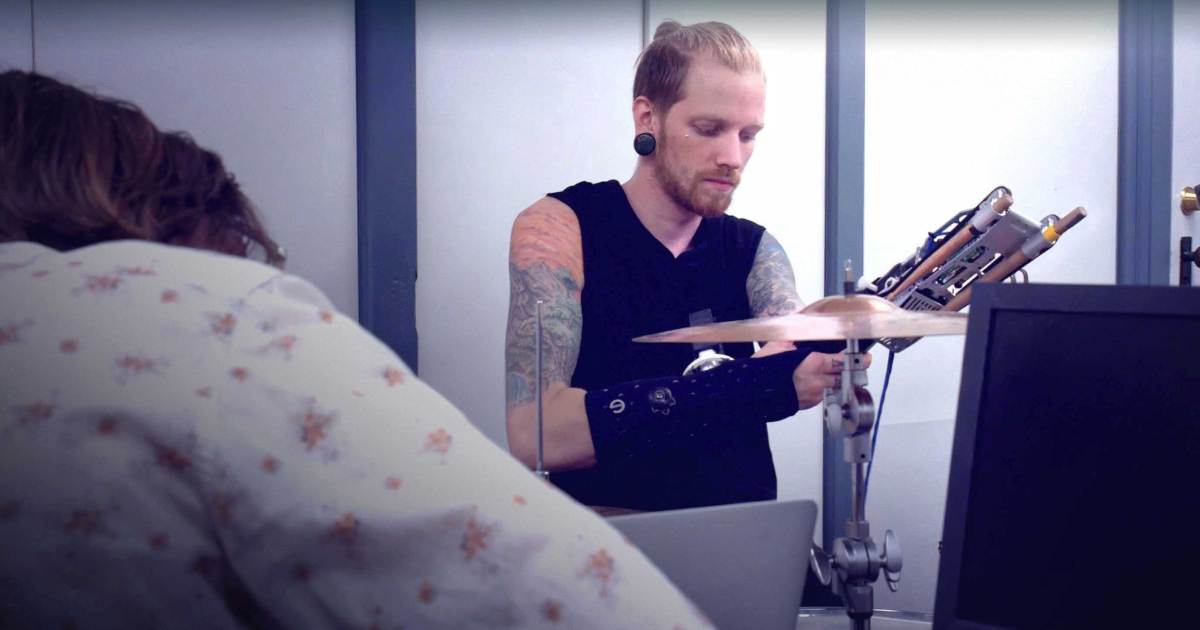 Meet the One-Armed Drummer With a Bionic Arm