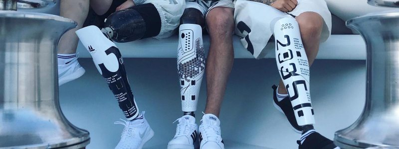 Prosthetic Leg Covers As Custom Wearable Art