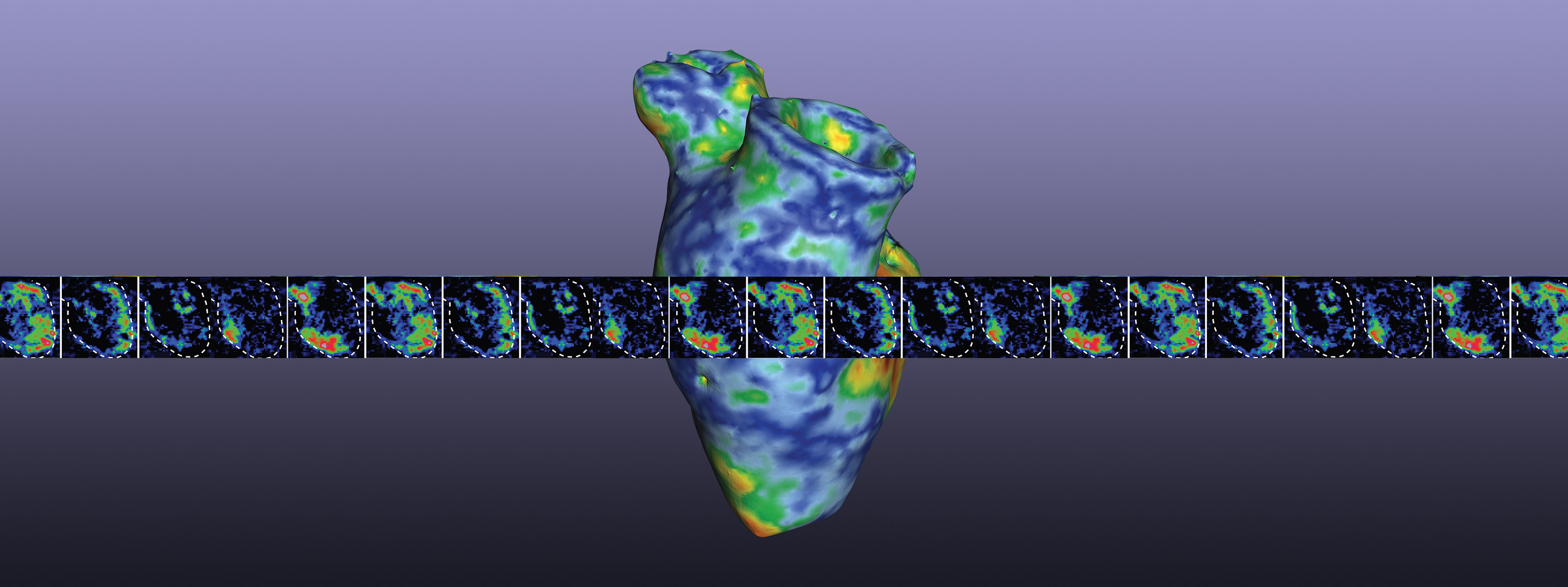 Scientists 3D print a heart pump that can beat on its own