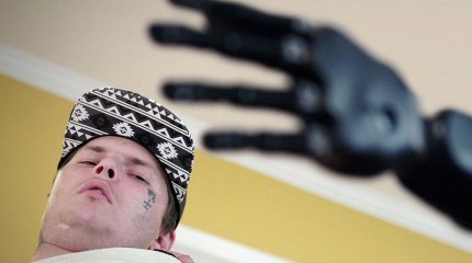 Meet the One-Armed Drummer With a Bionic Arm