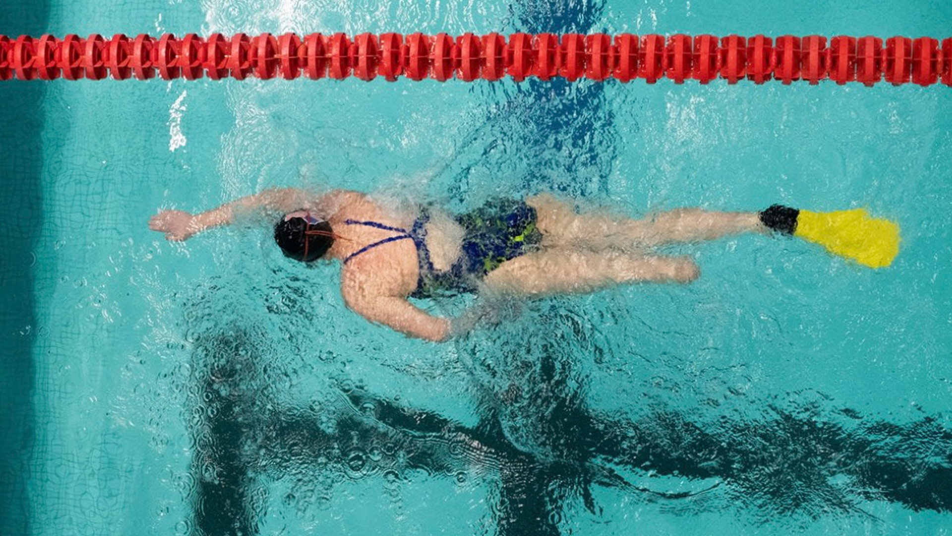 How a paralympic swimmer helps advance AI bionic limbs