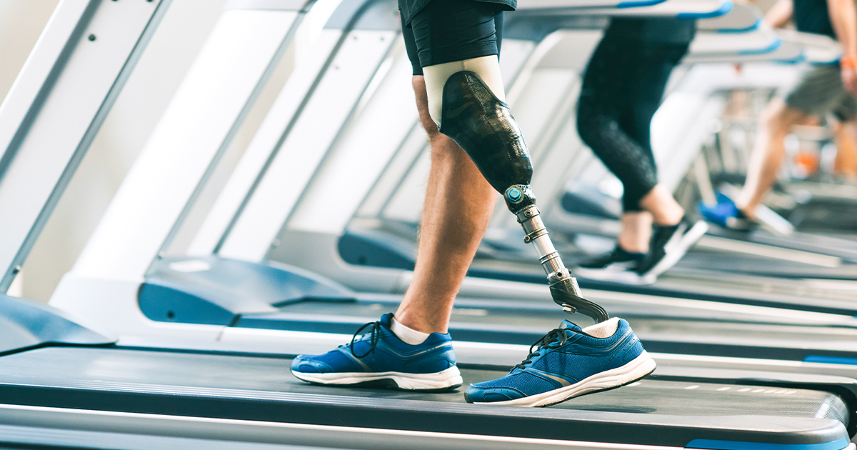 New amputation surgery technique may lead to better control of prosthetics