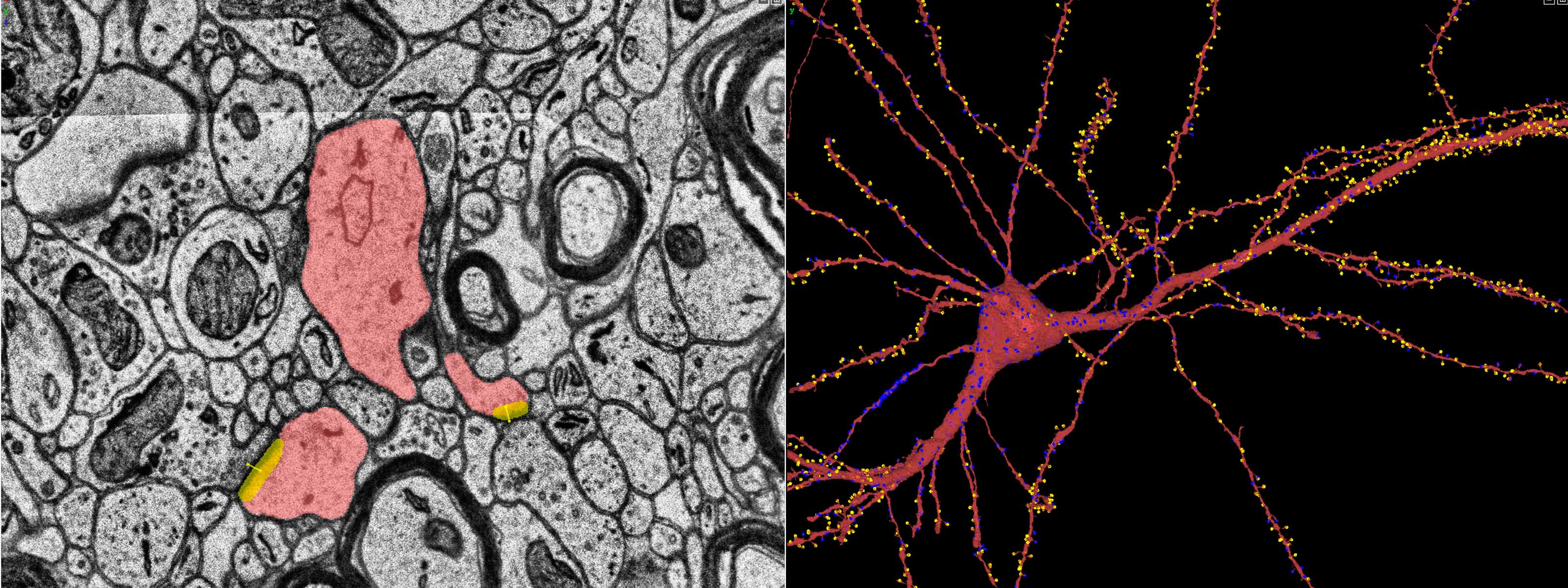 Google and Harvard have created the most detailed brain map yet