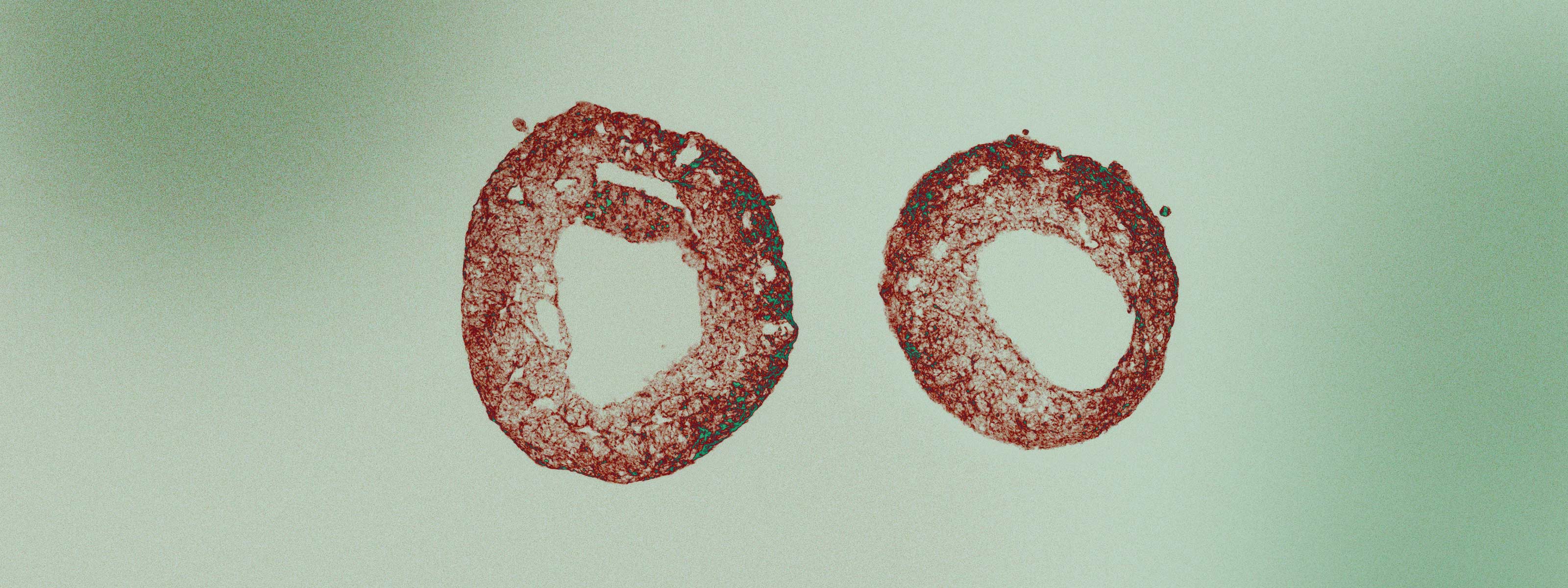 New lab-grown mini hearts have a human-like beat