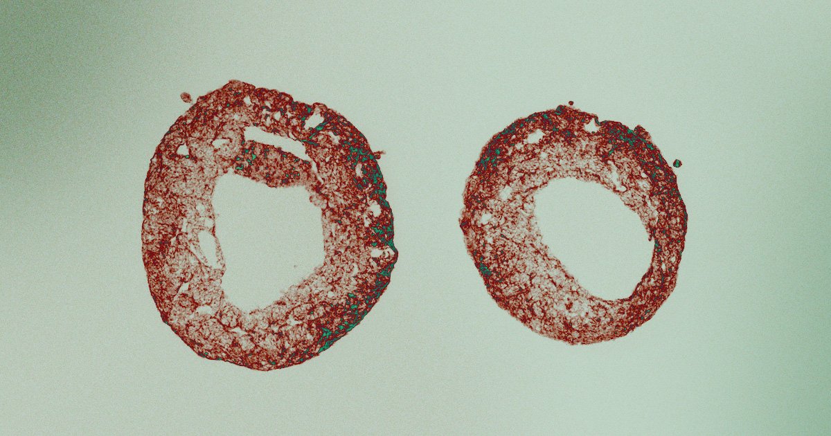 New lab-grown mini hearts have a human-like beat