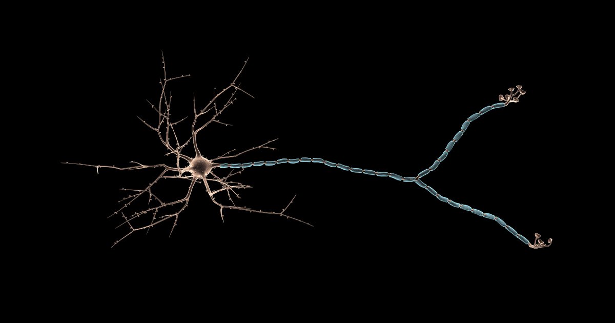 Experimental procedure zaps nerves to lower blood pressure