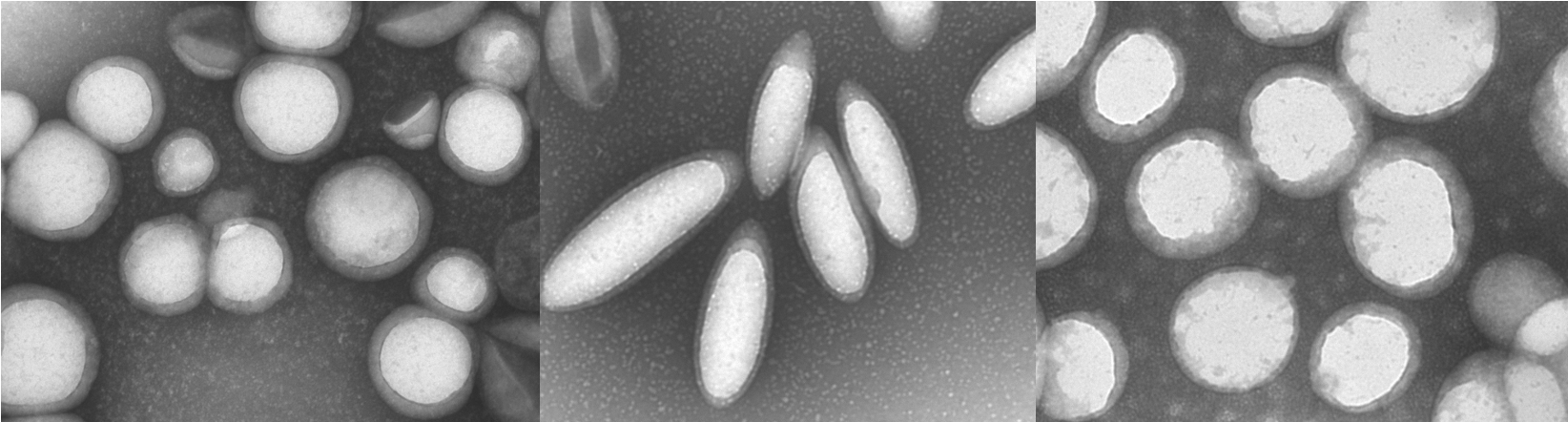 Nanoparticles Disguised as Red Blood Cells Sponge up Toxins