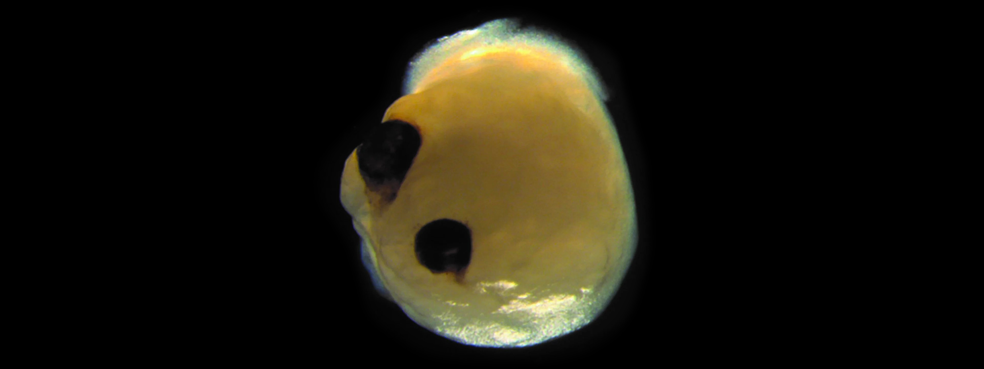 Mini brains grown in the lab sprout primitive “eyes”