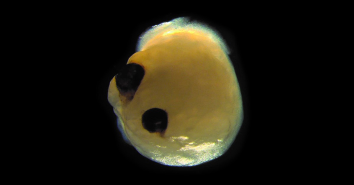 Mini brains grown in the lab sprout primitive “eyes”