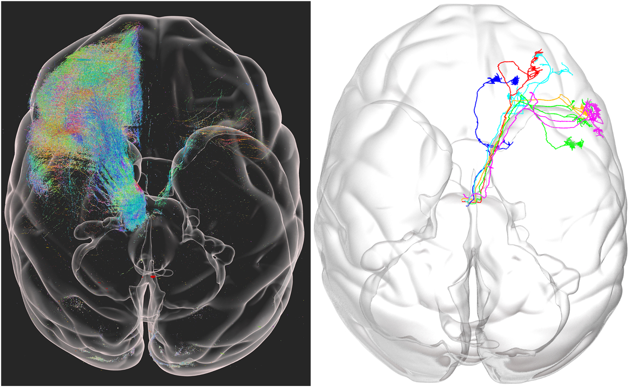 First neuron-level map of a monkey brain revealed