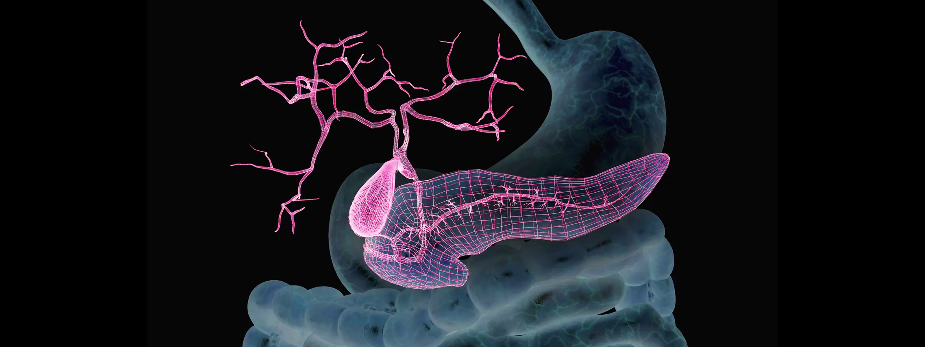 Artificial pancreas tested for the first time in type 2 diabetes patients