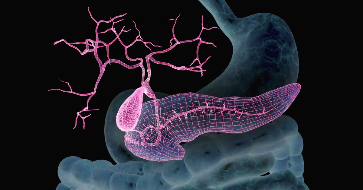 Artificial pancreas tested for the first time in type 2 diabetes patients