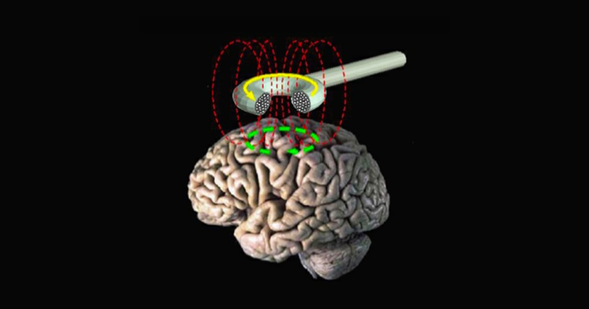 Magnetic brain stimulation nearly cures depression