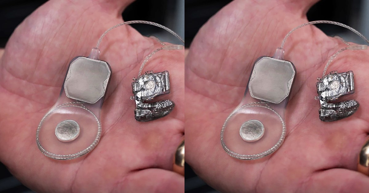 Experimental bionic eye is ready for human trials