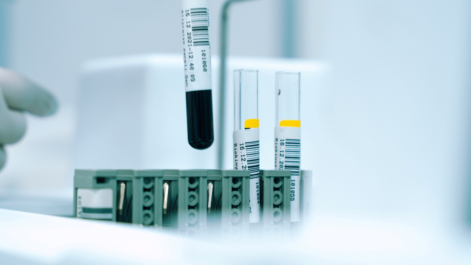 Golden blood: The rarest blood type in the world