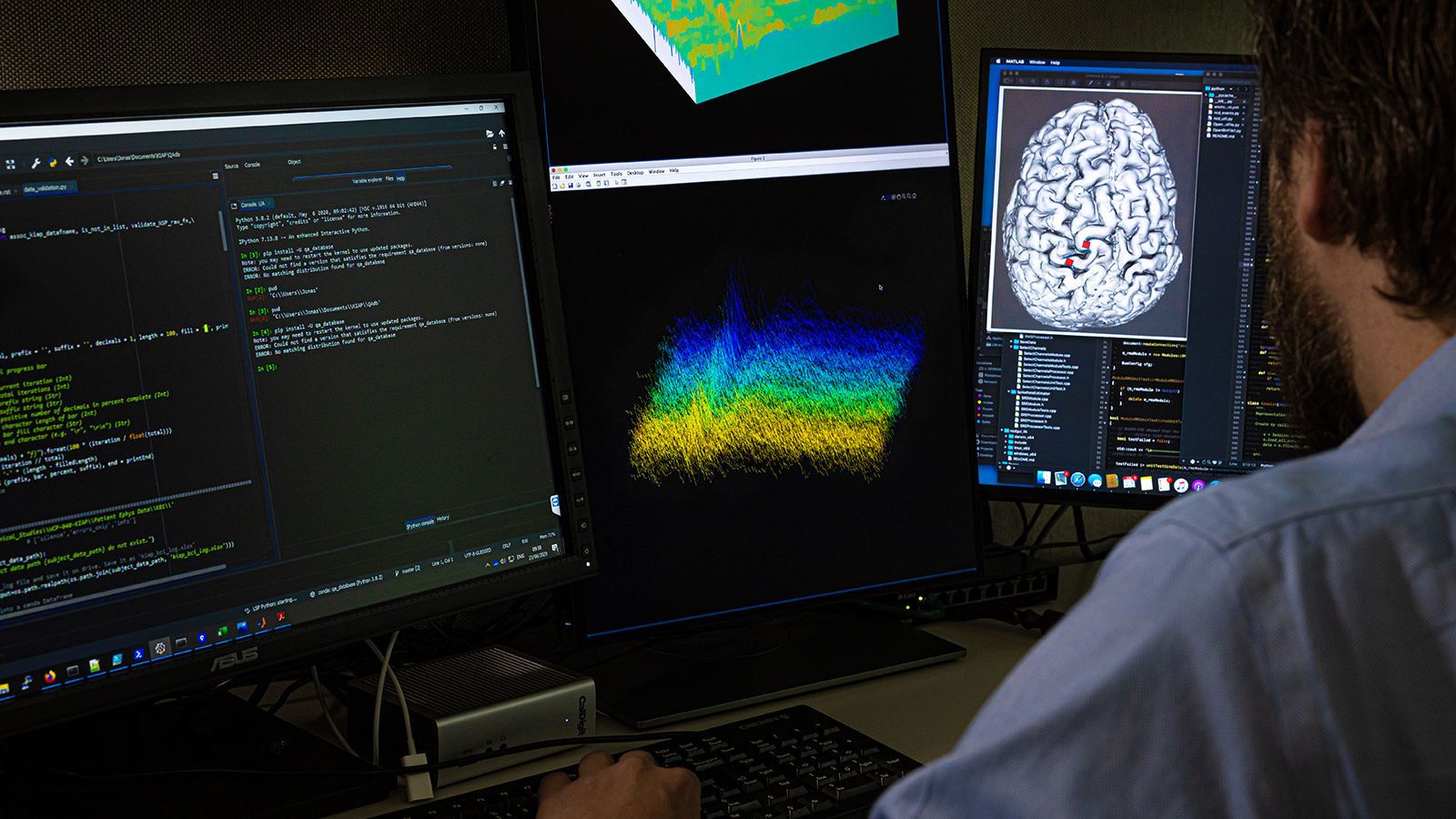 Brain implant lets man with locked-in syndrome share thoughts