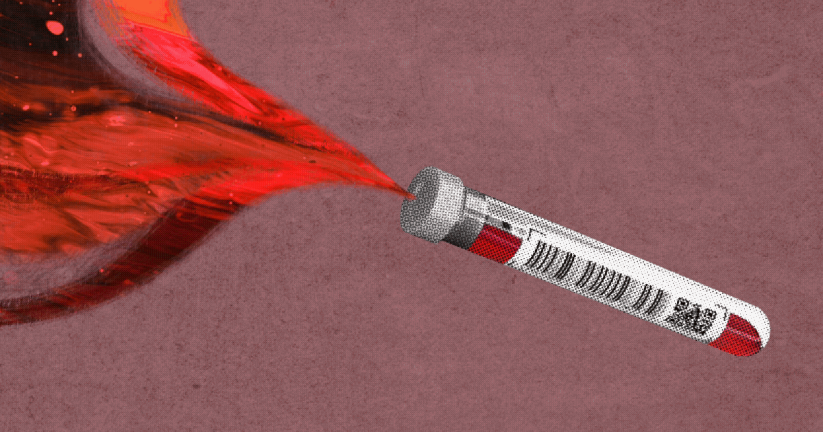 New test tells you how many T cells against COVID-19 you have