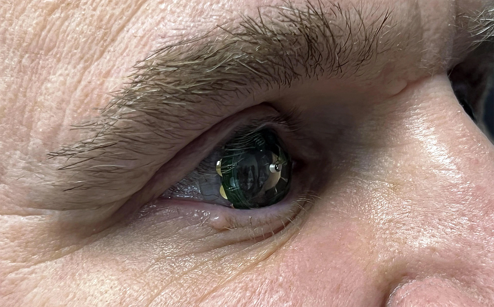 Mojo Vision CEO first to wear company’s smart contact lens