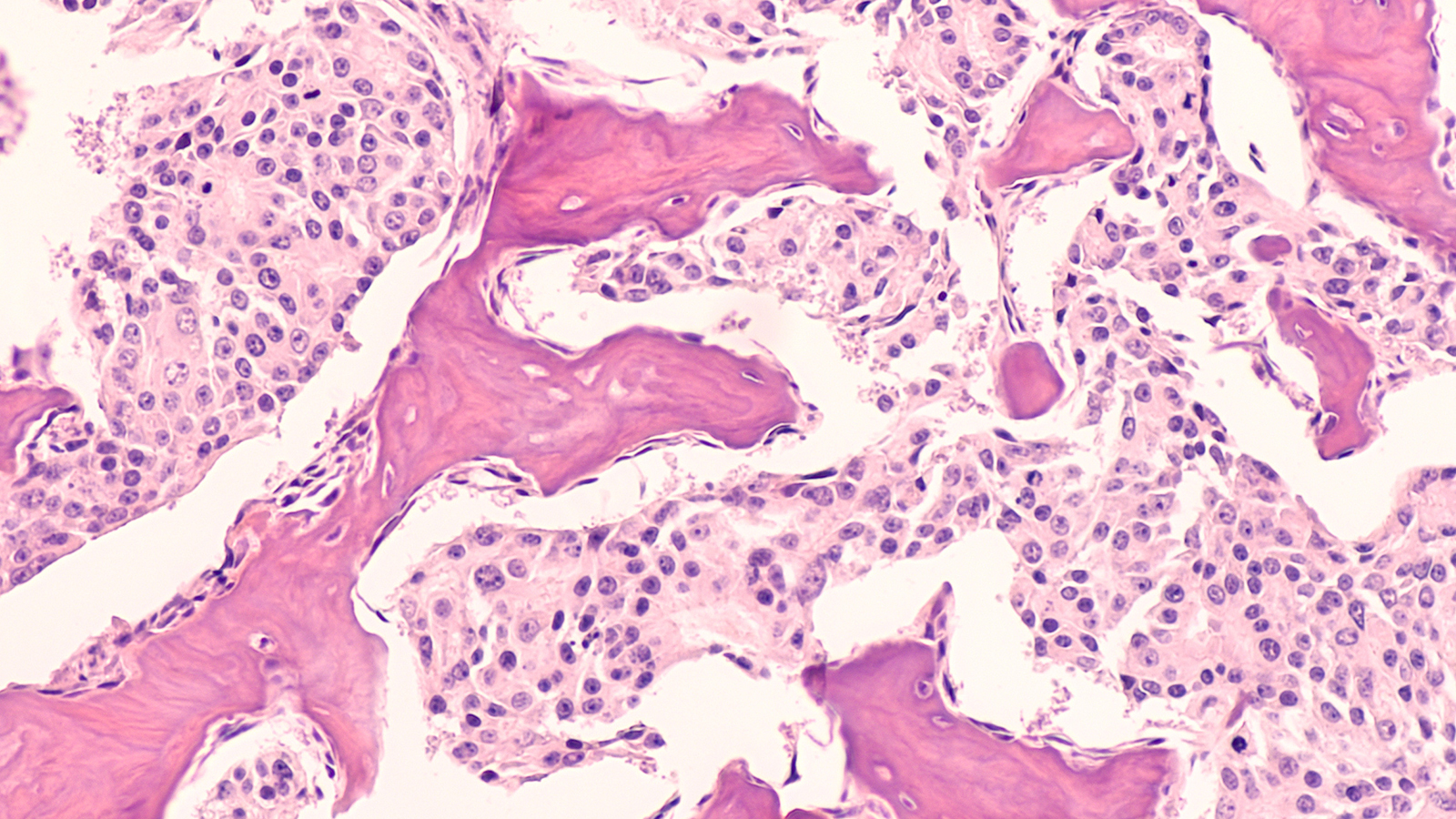 Cambridge researchers have discovered how cancer spreads