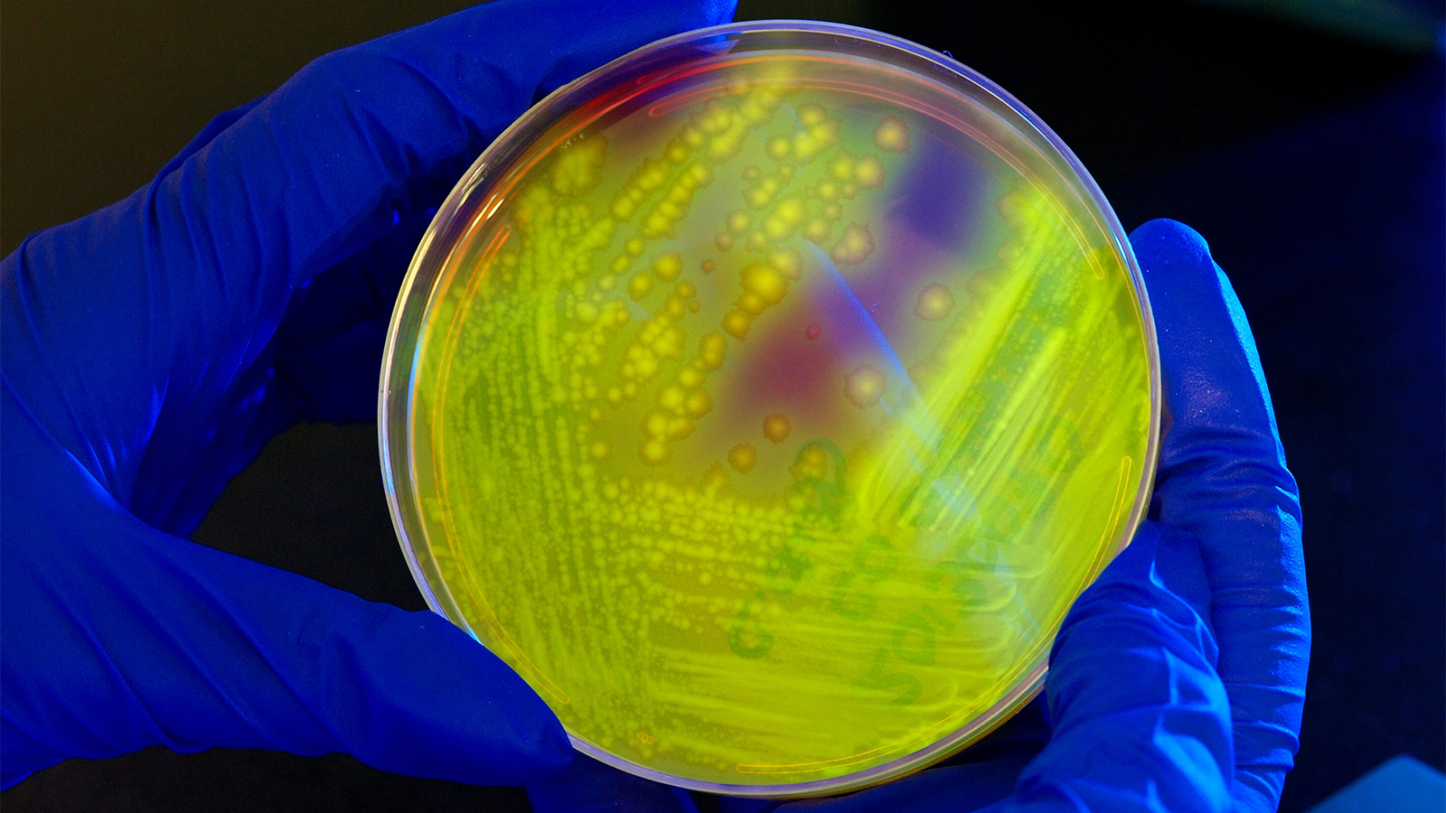 FDA approves US’s first fecal transplant therapy