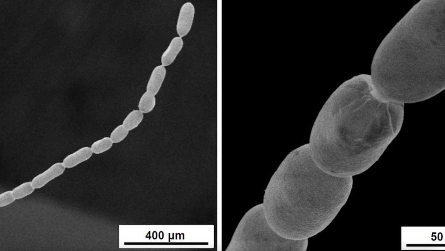 Mega bacteria that can be seen with naked eye shakes up the field of ...