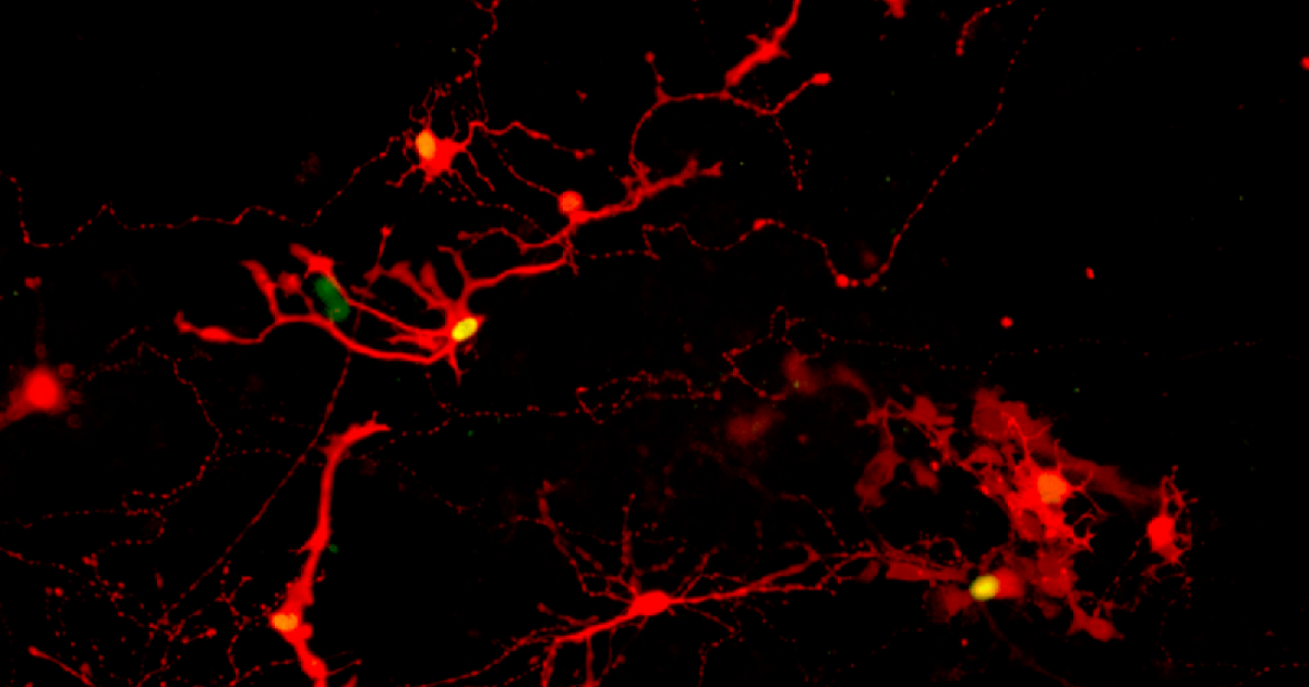 Lab-grown eye cells move toward human trials