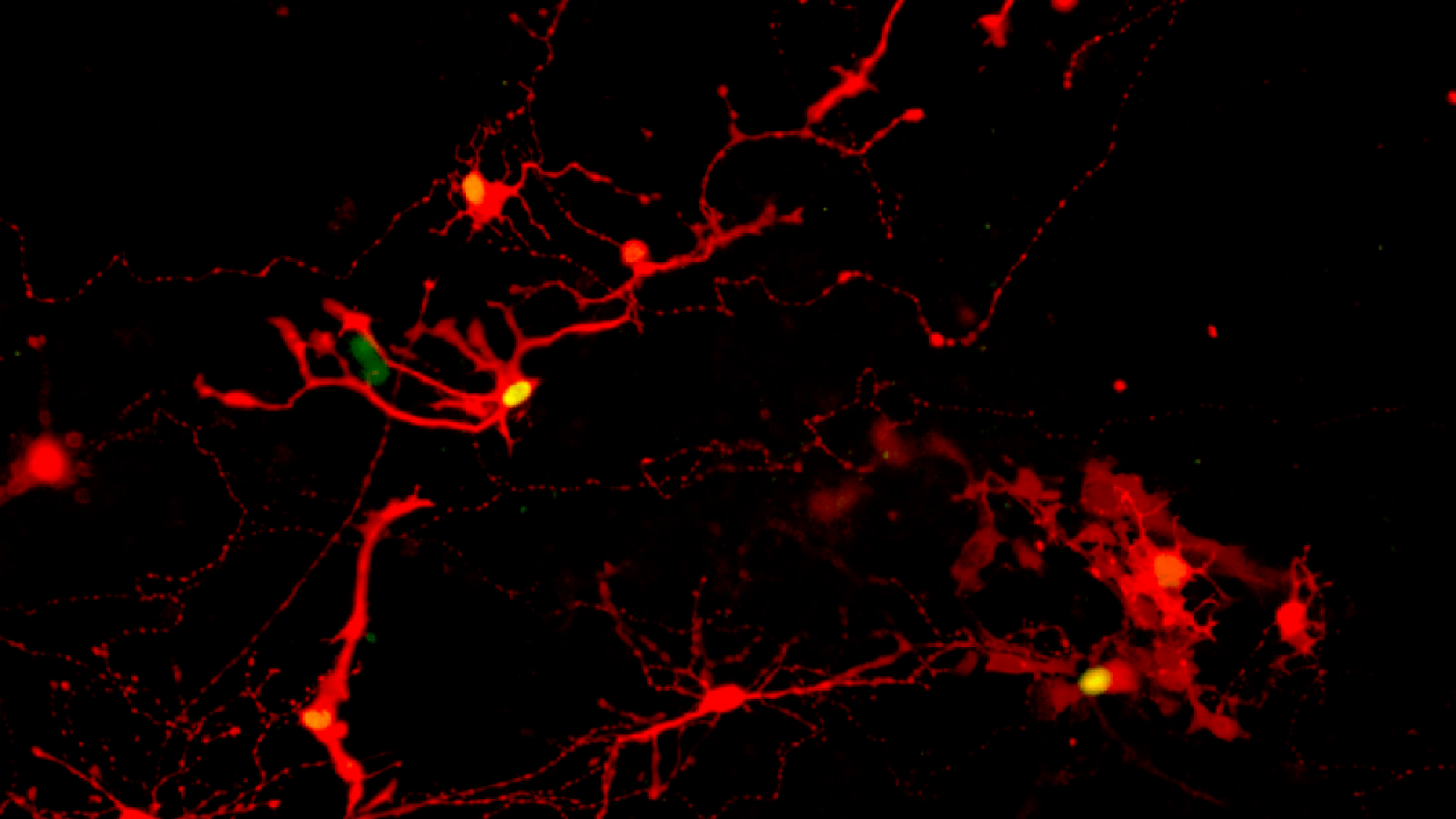 Lab-grown eye cells move toward human trials