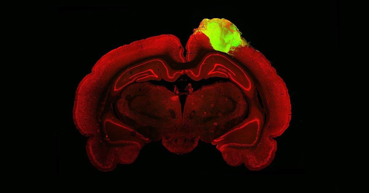 Human mini brains illuminate path to curing blindness