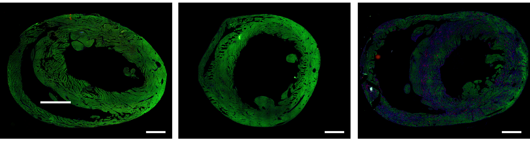 Scientists treated heart attacks in mice — before they happened
