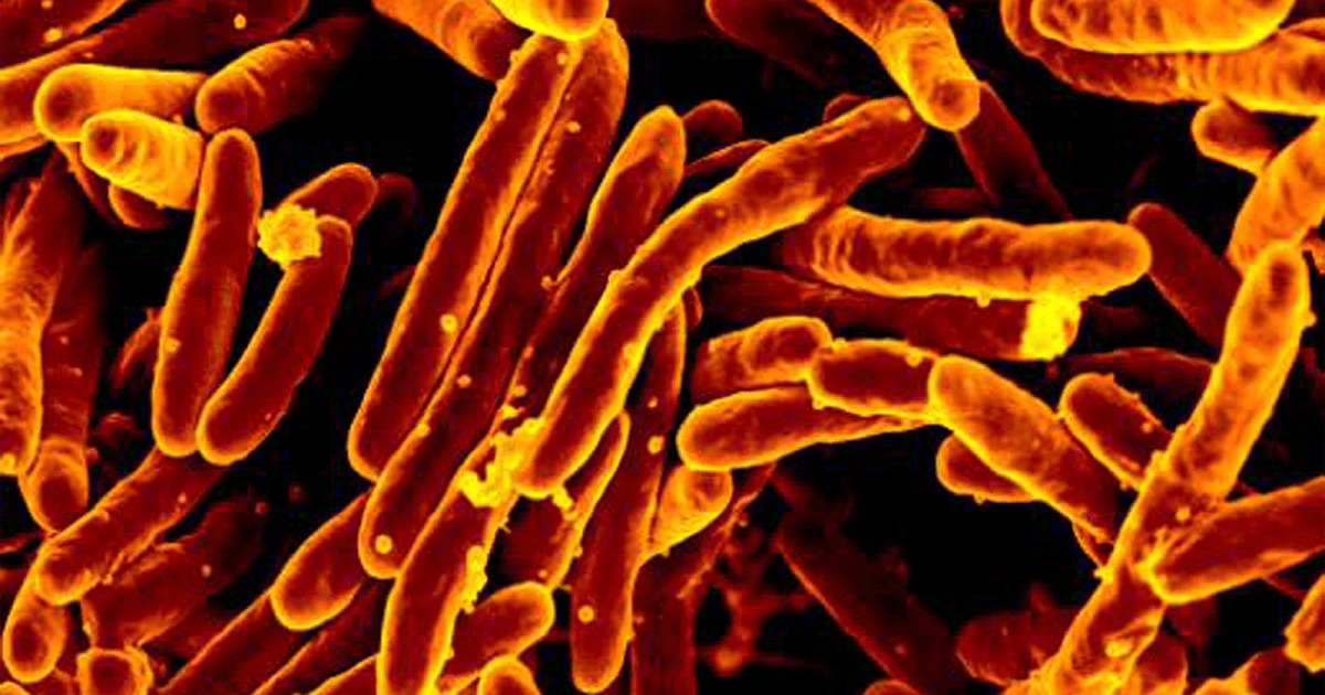 Tuberculosis kills over a million people a year. New breakthroughs may ...