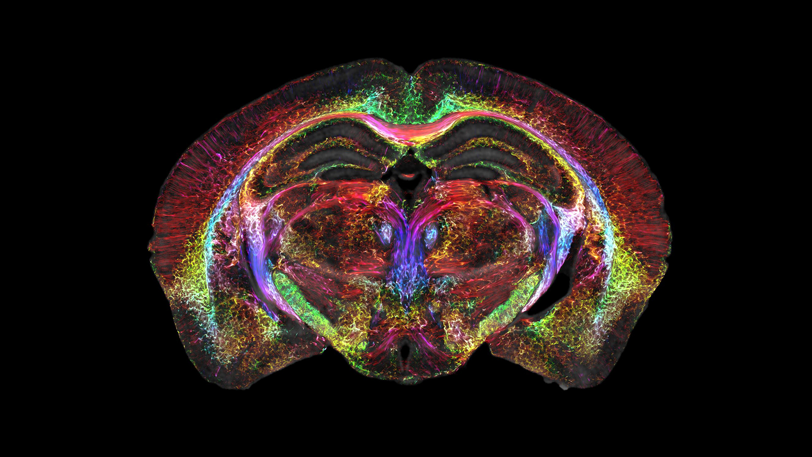 New brain imaging tech is 64 million times sharper than clinical MRI