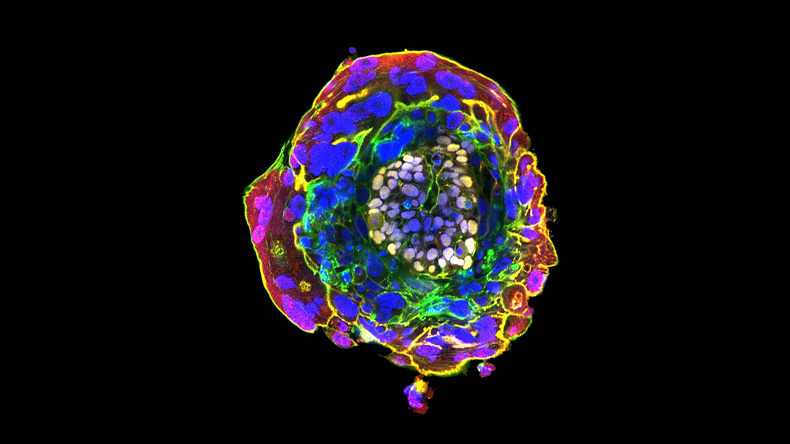 Model human embryo, made from stem cells, survives past 14 days