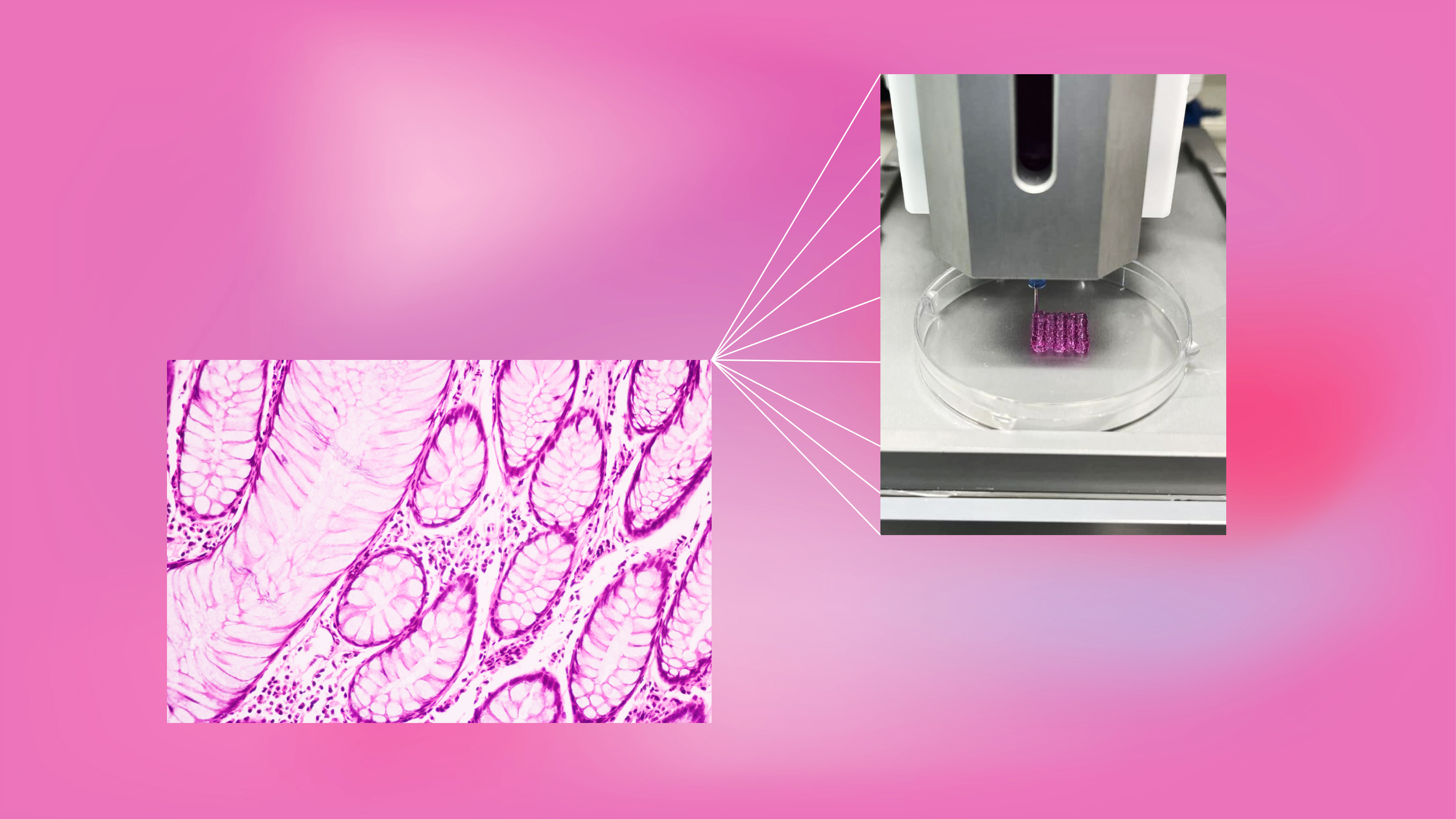 3D Printing - Freethink