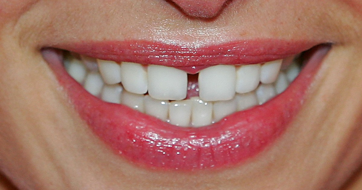 Drug to grow new teeth heads to human trials
