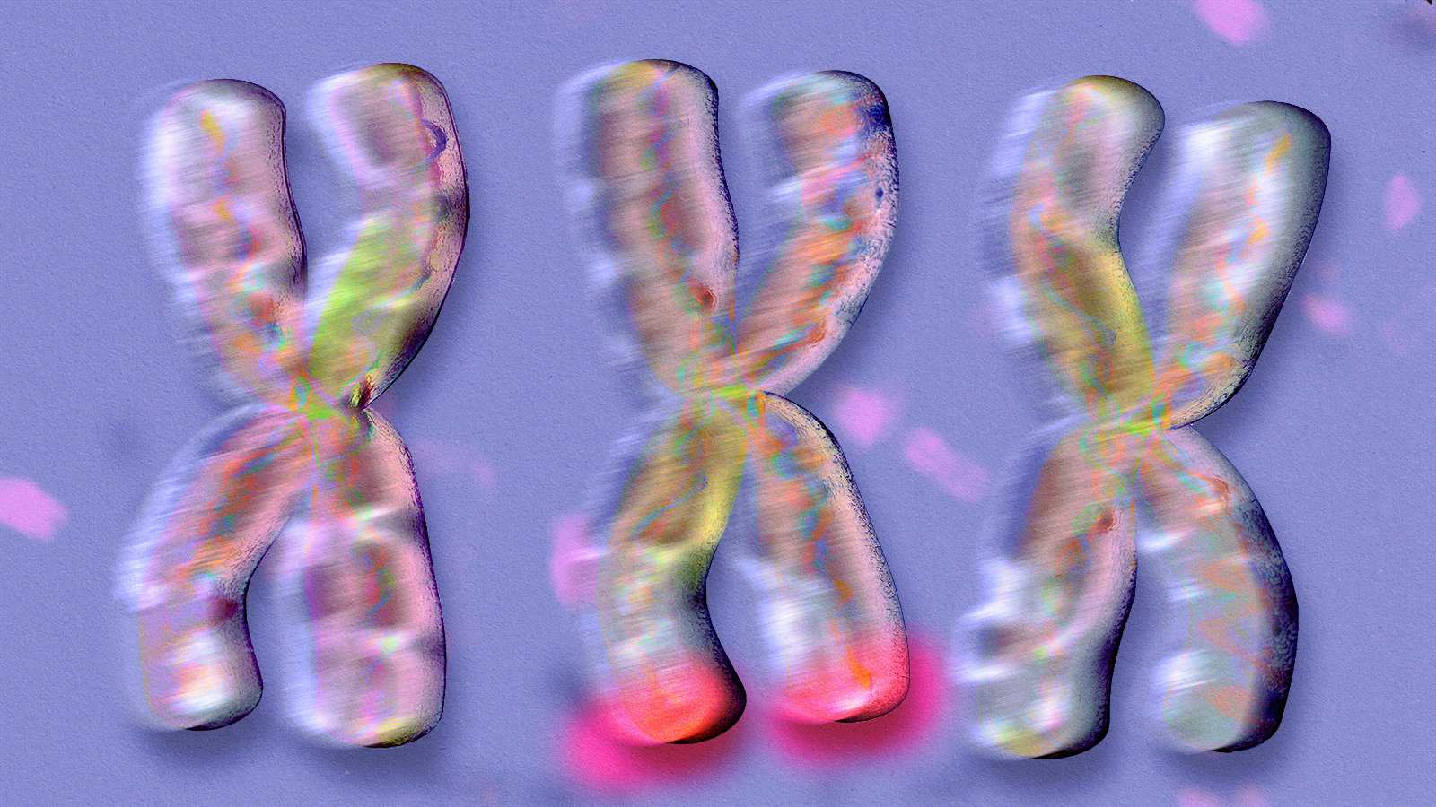 Fragile X syndrome often results from improperly processed genetic material