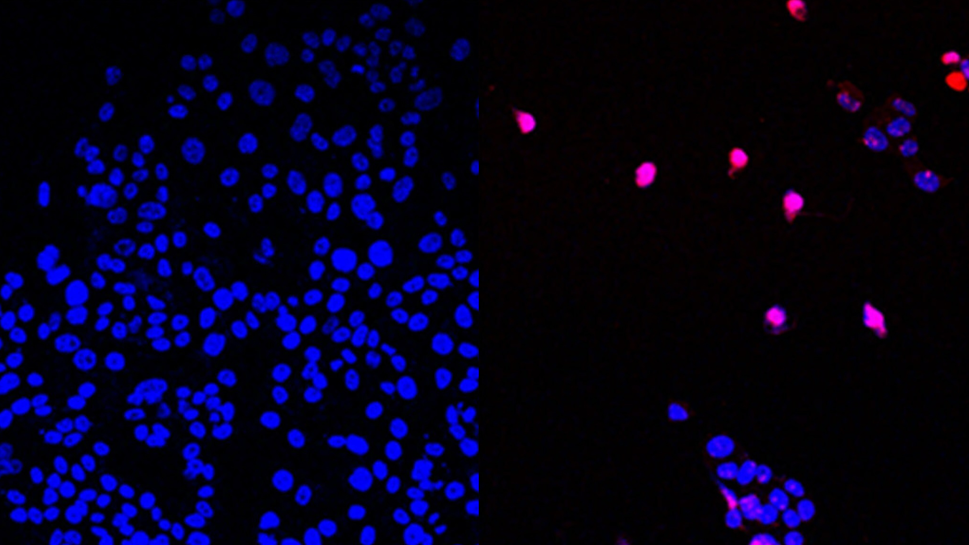 Targeted therapy kills every type of cancer in the lab