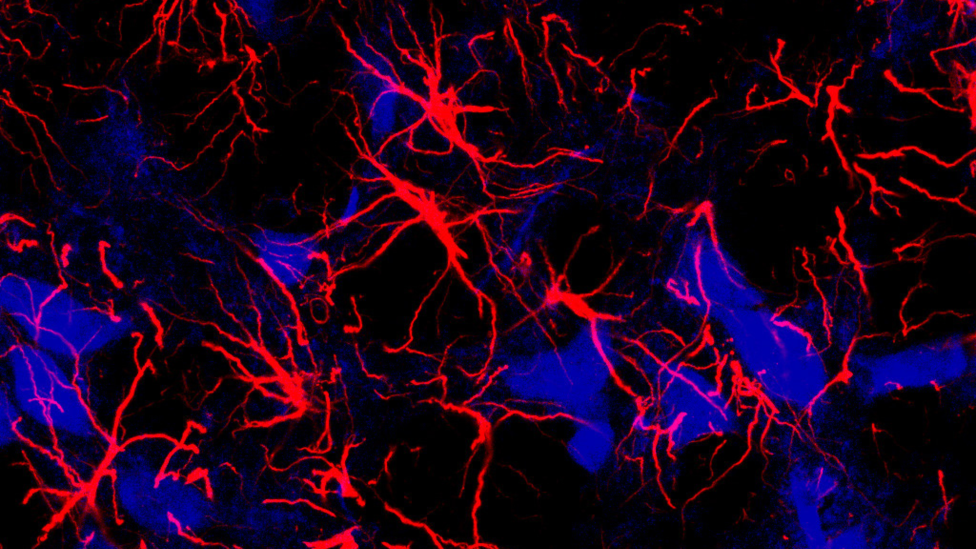 Scientists discover a new kind of brain cell