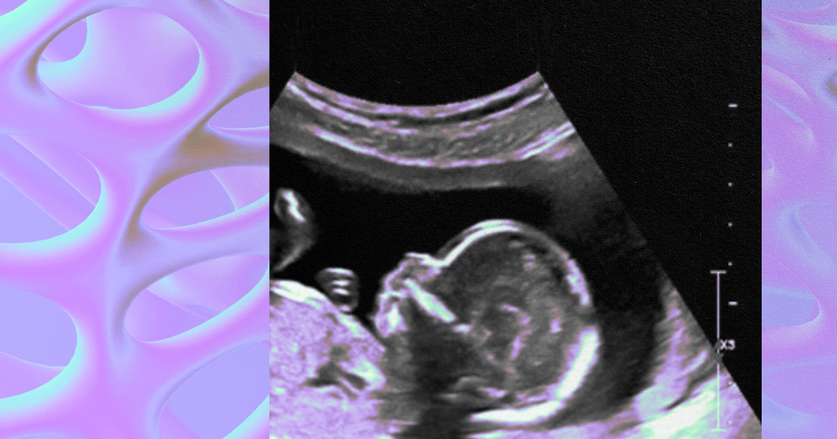Artificial wombs for premature babies move closer to human trials