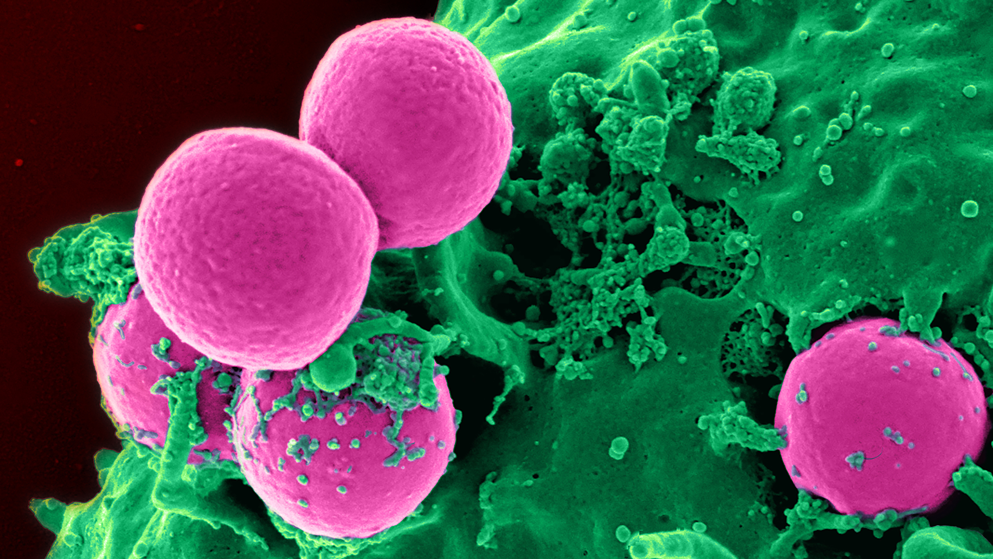 New superbug vaccine turns the immune system into “the Hulk”