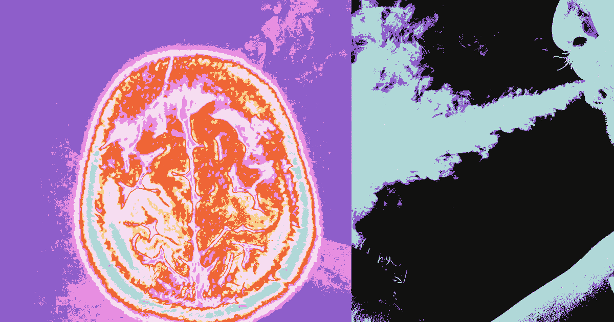 The psychedelic DMT causes the brain to become hyperconnected, scans reveal