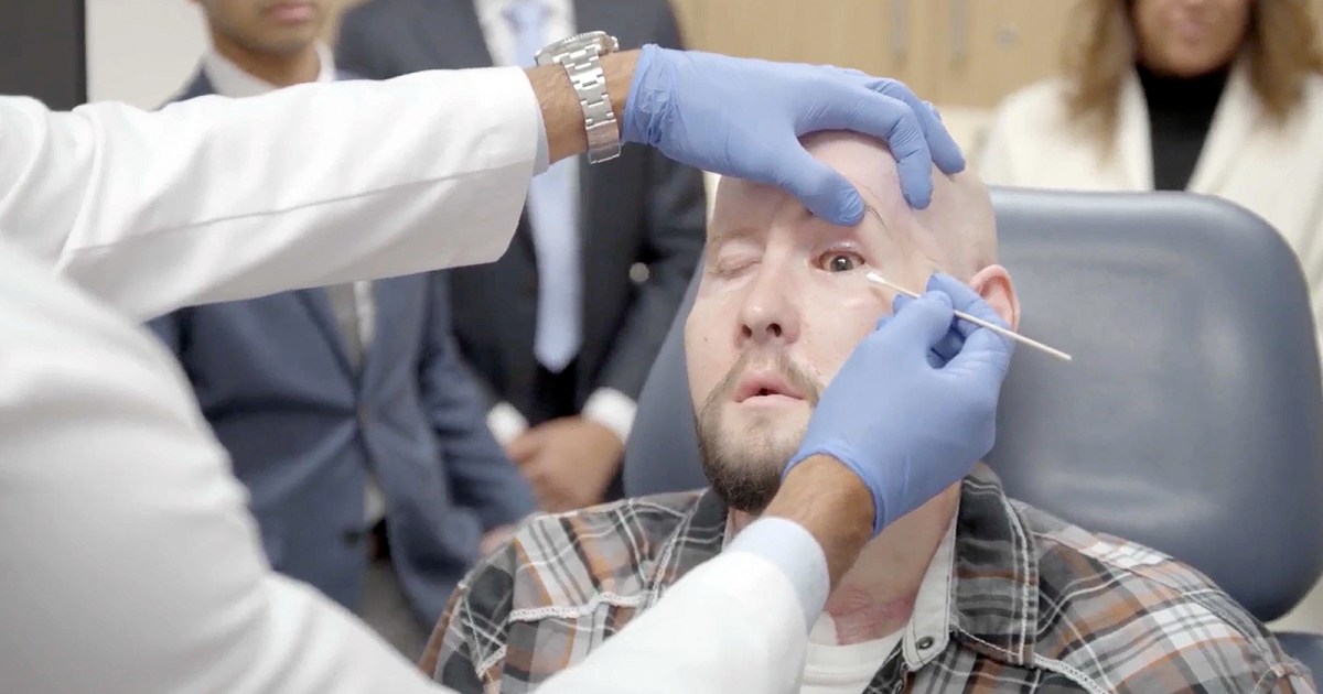 Arkansas man receives world’s first eye transplant