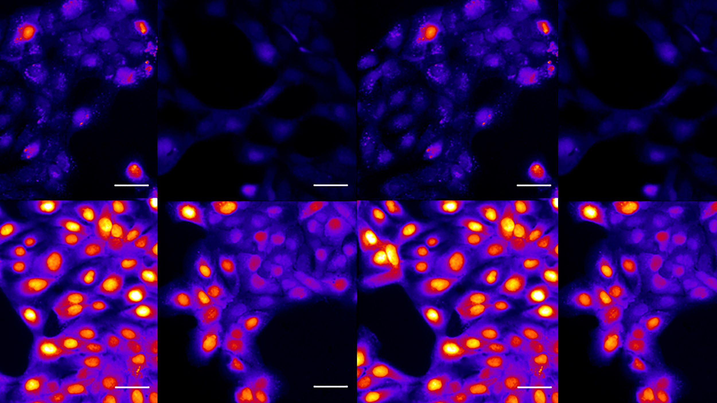 Lidocaine makes cancer cells self-destruct, study finds