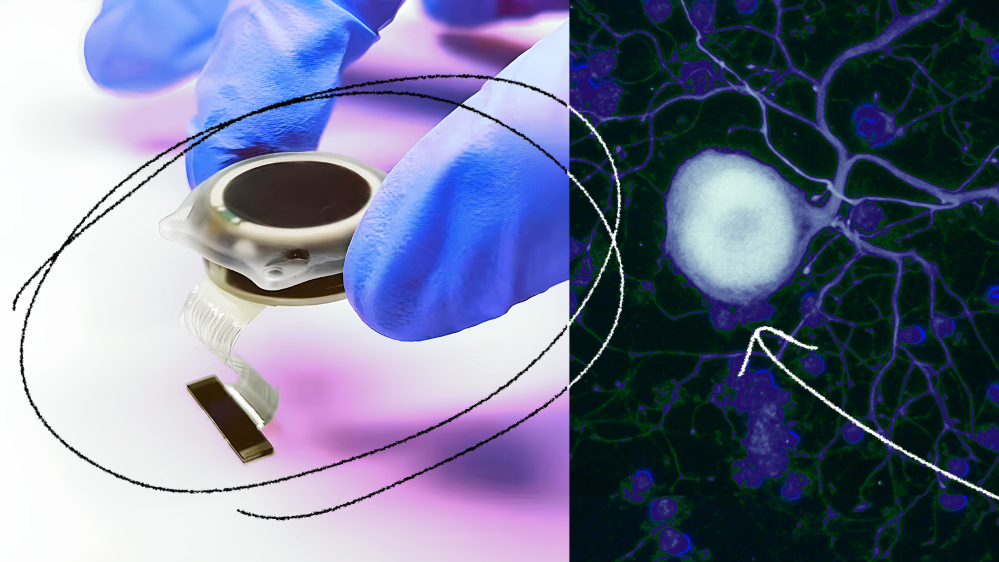 Elon Musk’s Neuralink has implanted its first device in a human